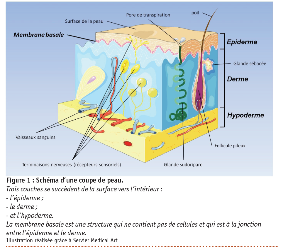 Qu’est-ce que l’épidermolyse bulleuse héréditaire ? - Debra France